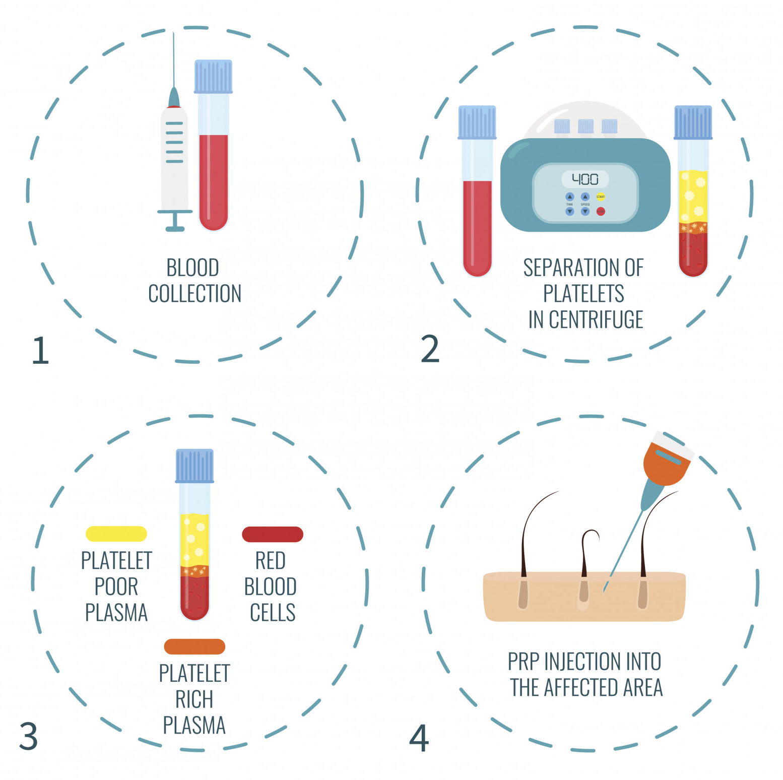 Platelet Rich Plasma Therapies