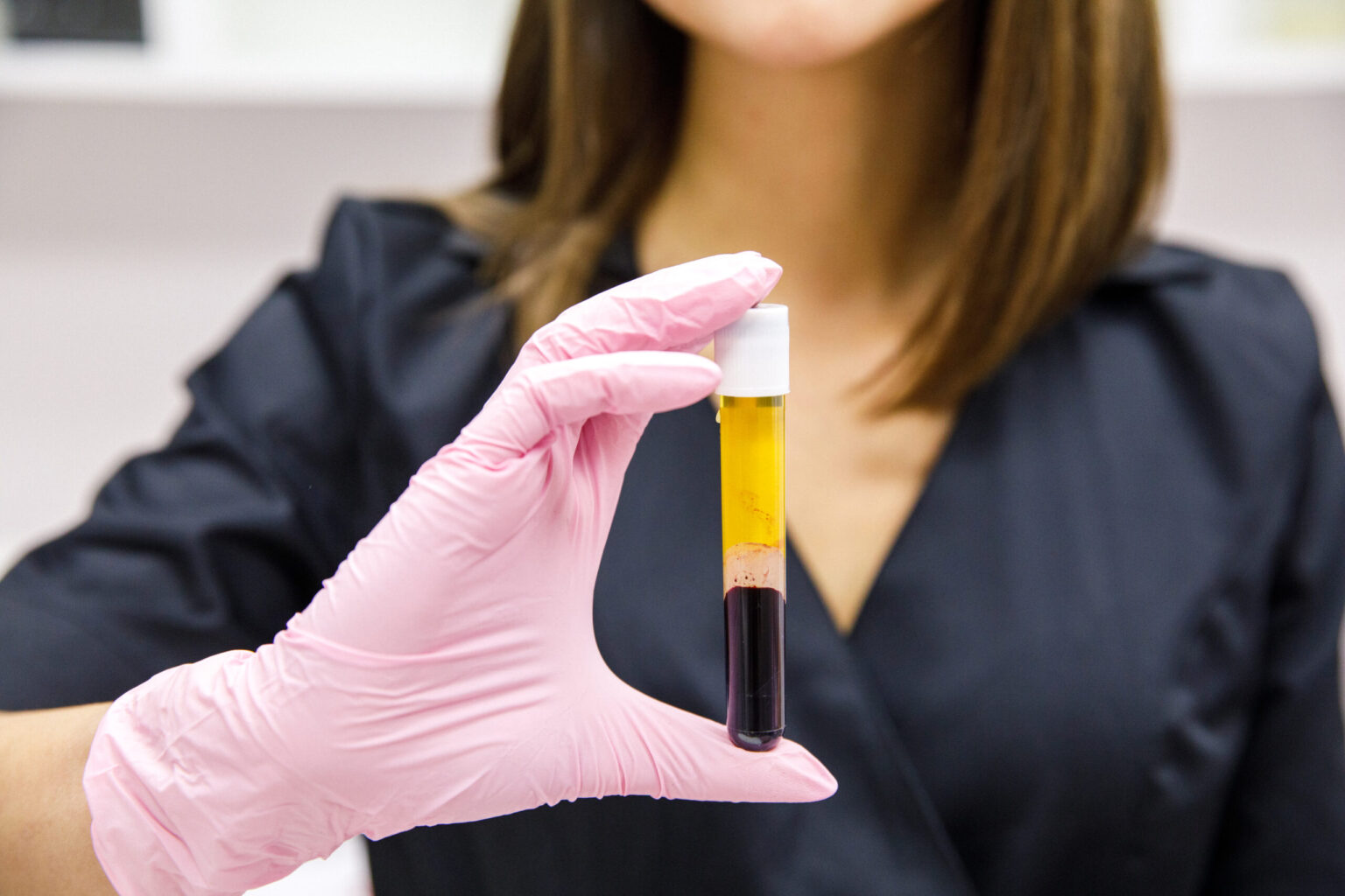 4 Life-Changing Uses for PRP - Hinsdale Vein and Laser