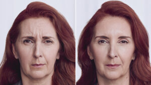 Monthly Specials - Hinsdale Vein and Laser